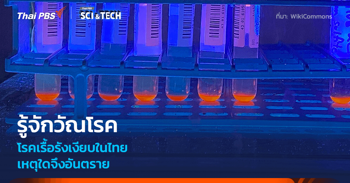 รู้จัก “วัณโรค” โรคร้ายใกล้ตัวที่ยังไม่หมดไปจากสังคมไทย | Thai PBS NOW