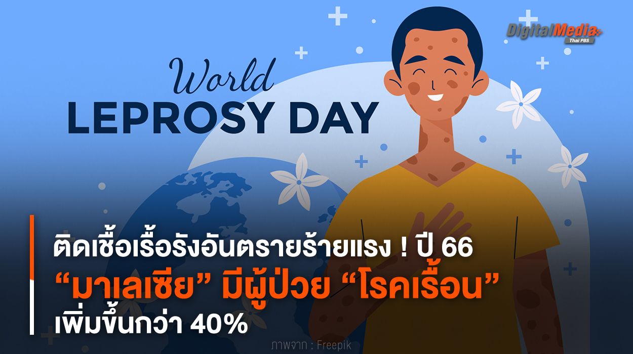 ติดเชื้อเรื้อรังร้ายแรง ! ปี 66 “มาเลเซีย” มีผู้ป่วย “โรคเรื้อน” เพิ่มขึ้น 40% | Thai PBS NOW