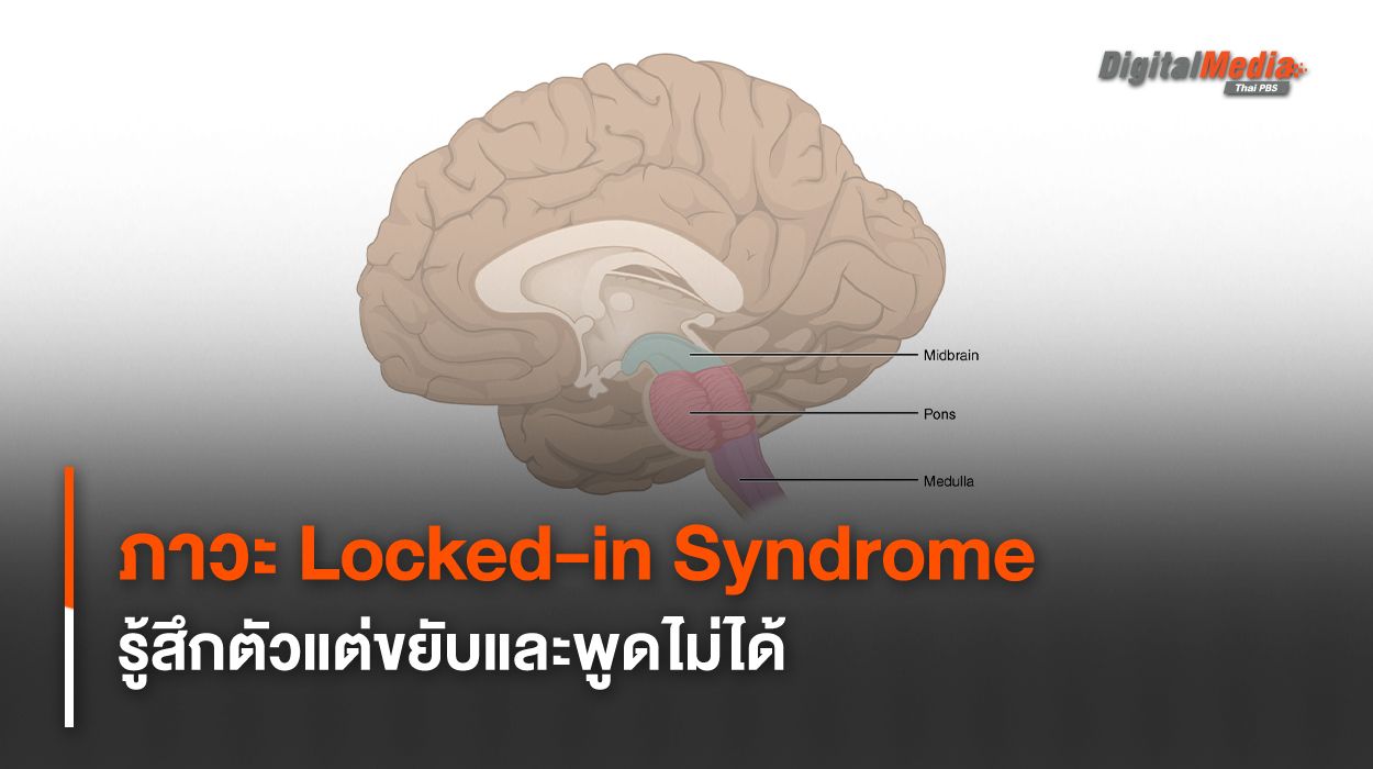 รู้จักภาวะ “Locked-in syndrome” รู้สึกตัวแต่ไม่สามารถขยับได้ | Thai PBS NOW